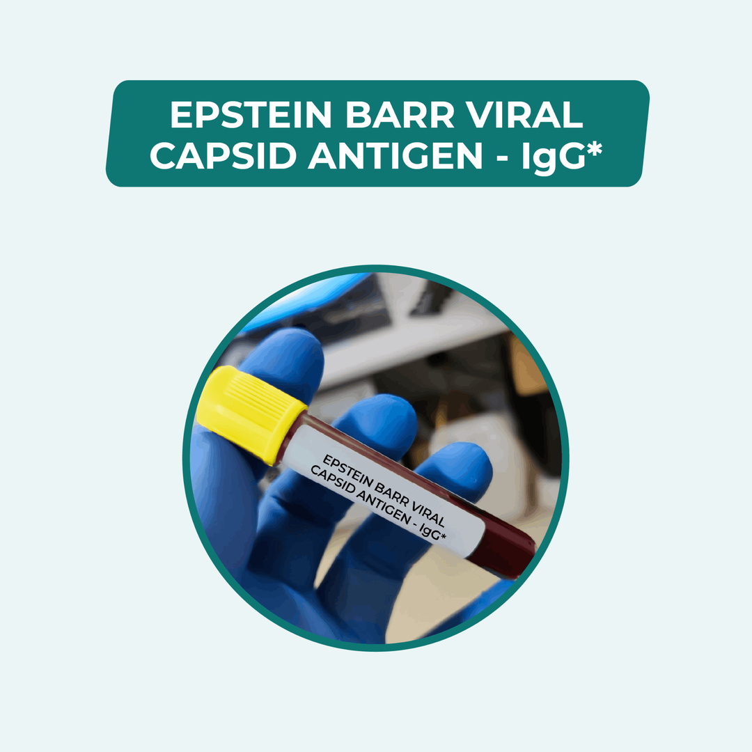 EPSTEIN BARR VIRAL CAPSID ANTIGEN - IgG - Arogga Online Lab
