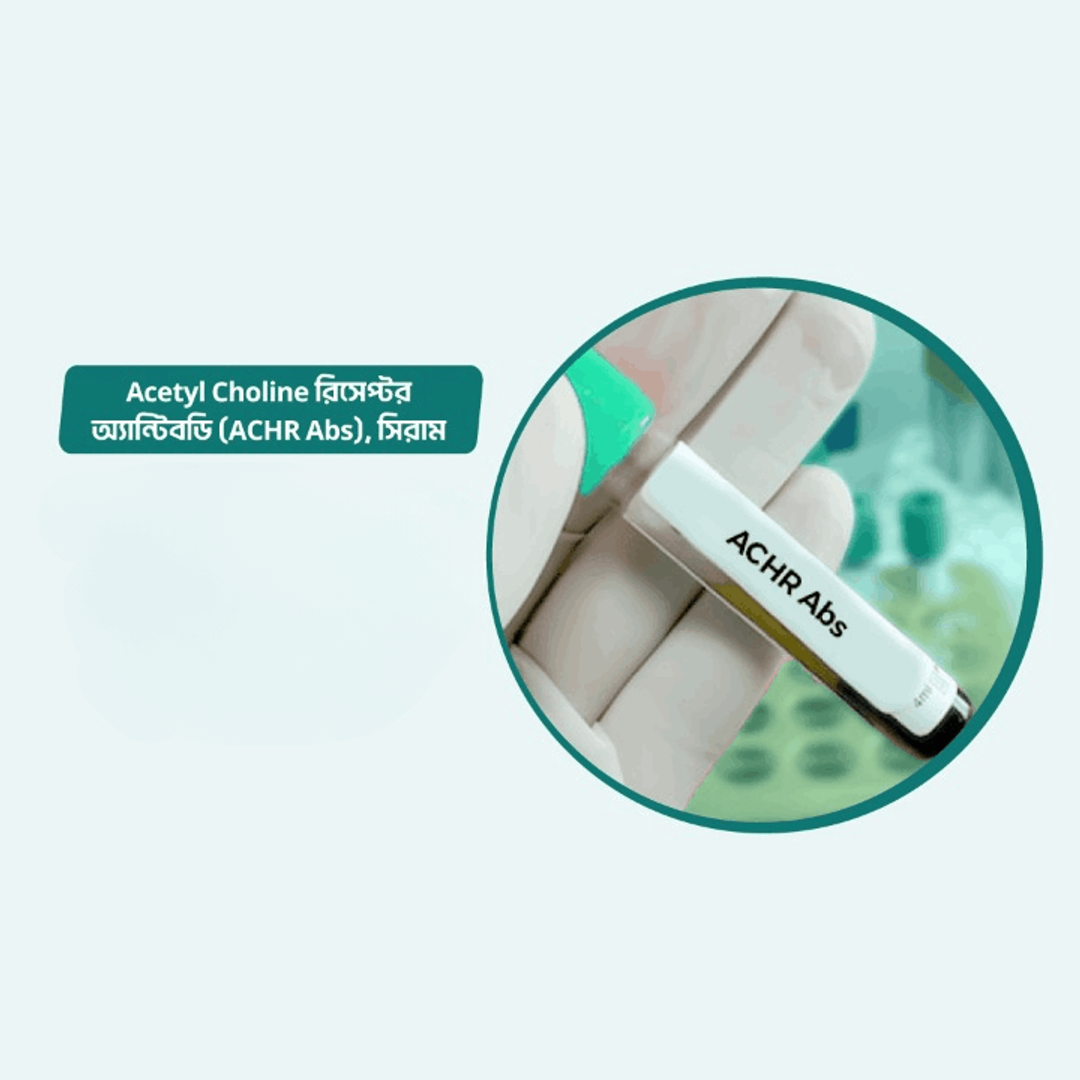 Acetyl Choline Receptor Antibodies (ACHR Abs), Serum test Online in ...