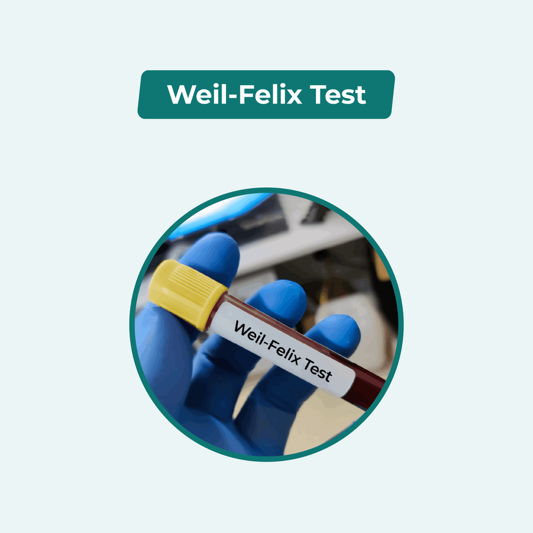 Weil Felix Test - Arogga Online Lab