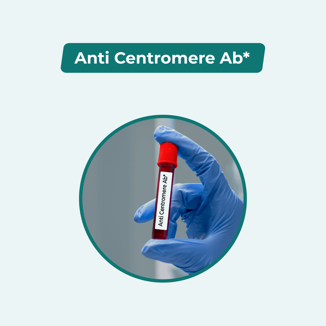 Anti Centromere Ab - Arogga Online Lab