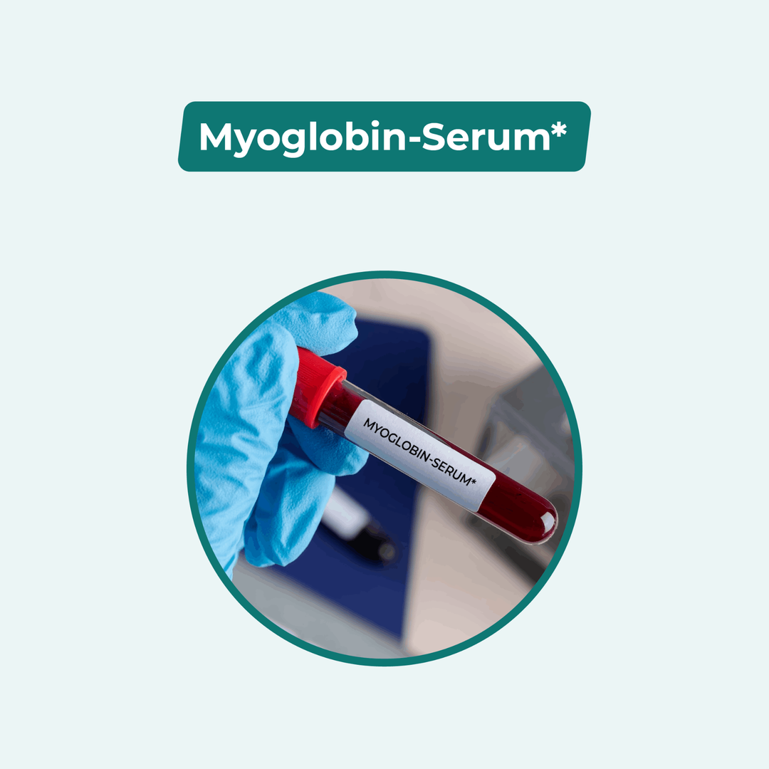 Myoglobin-Serum - Arogga Online Lab