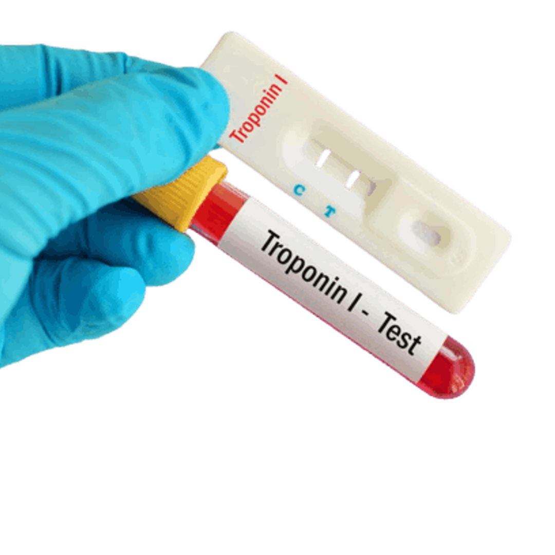 Troponin - I - Arogga Online Lab