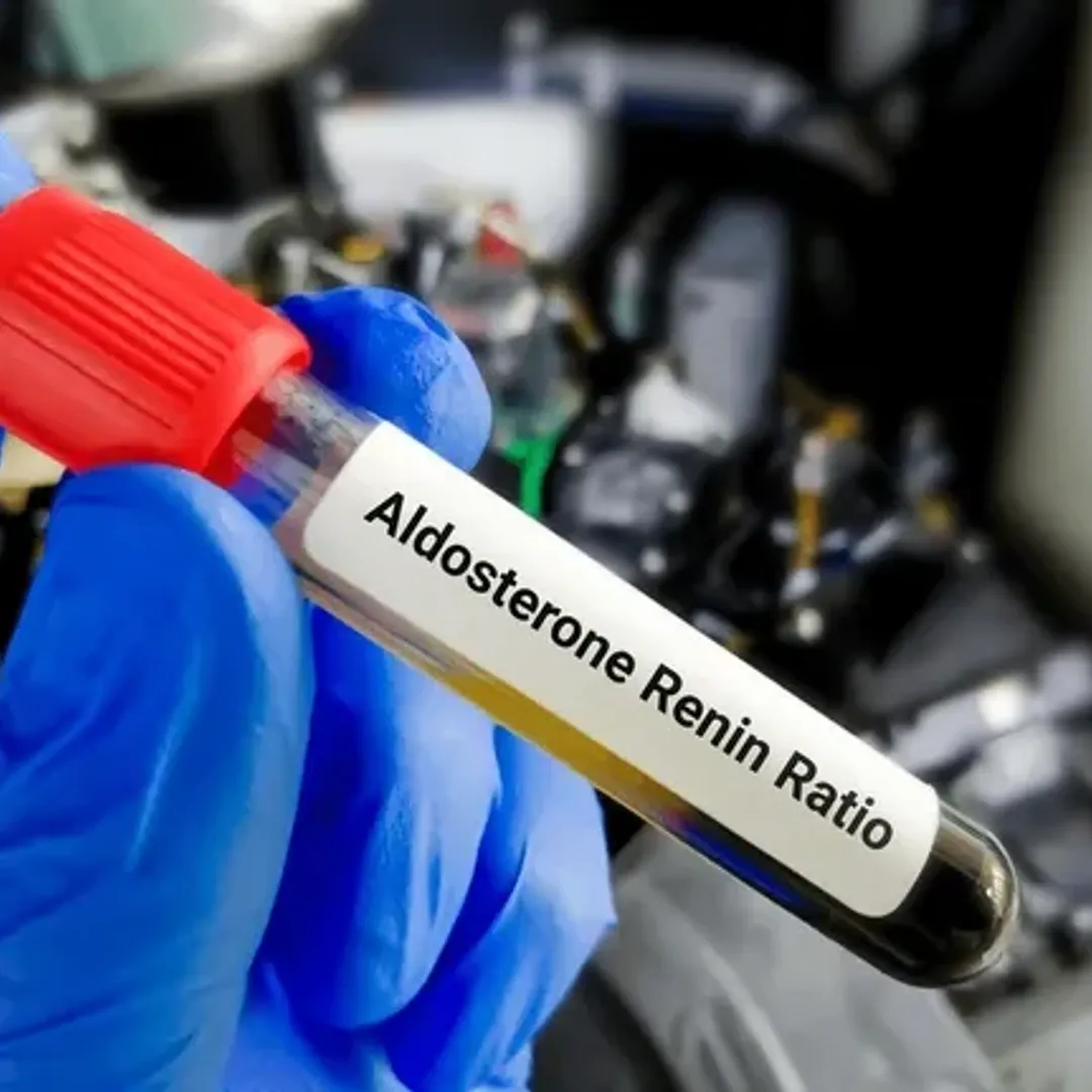 ALDOSTERONE / PLASMA RENIN DIRECT RATIO - Arogga Online Lab