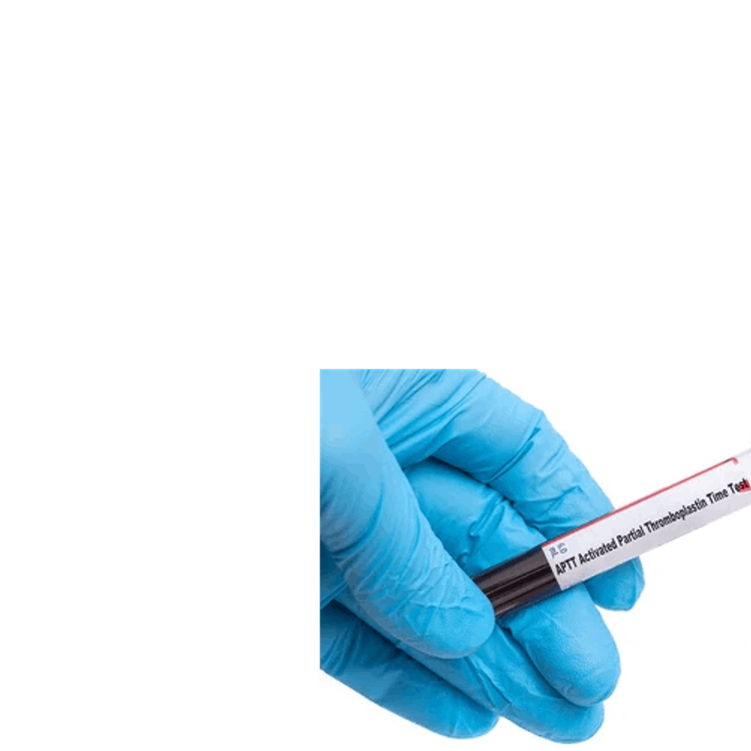 Activated Partial Thrombin Time (APTT) - Arogga Online Lab