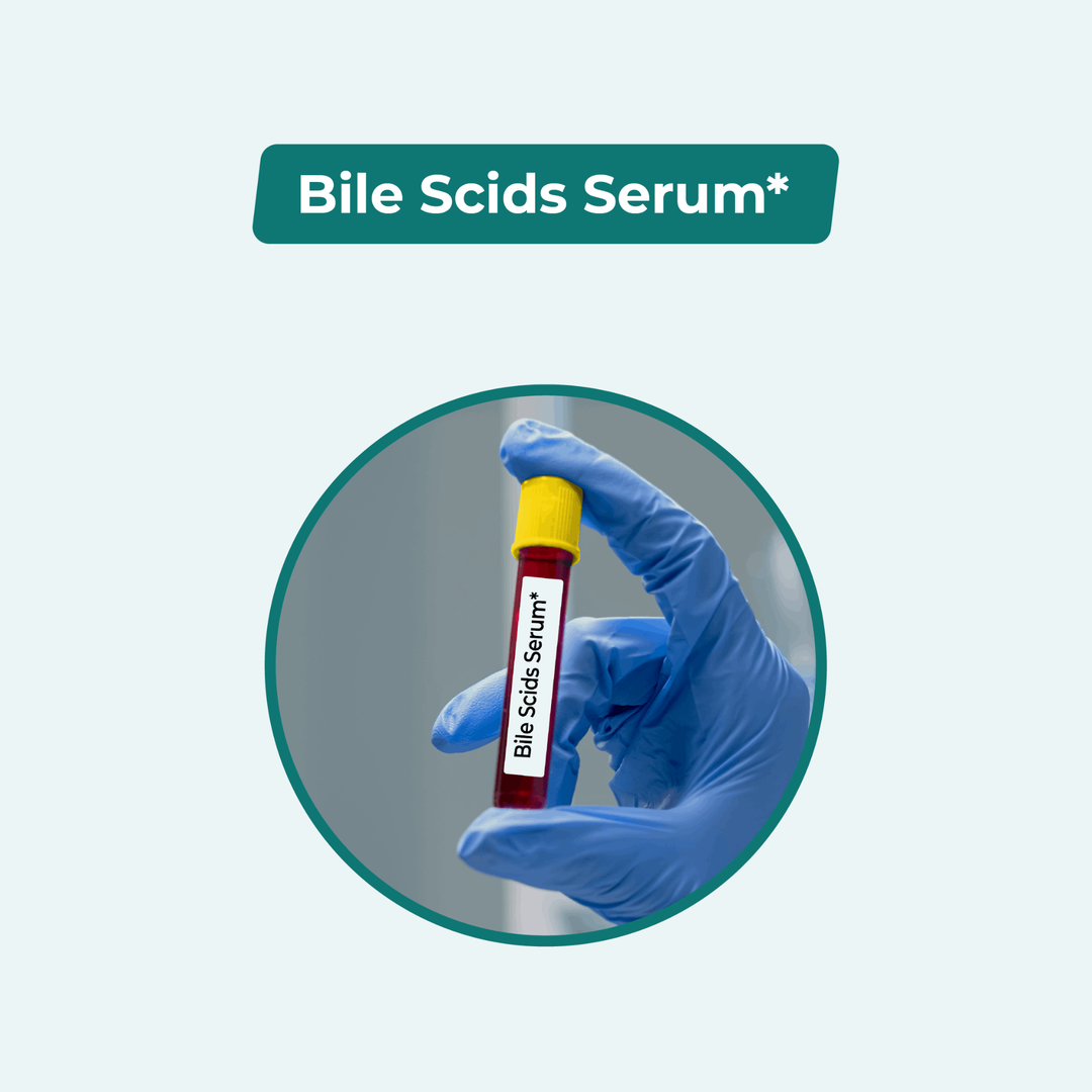 Serum Bile Acid test Online in Dhaka | Arogga Online Lab