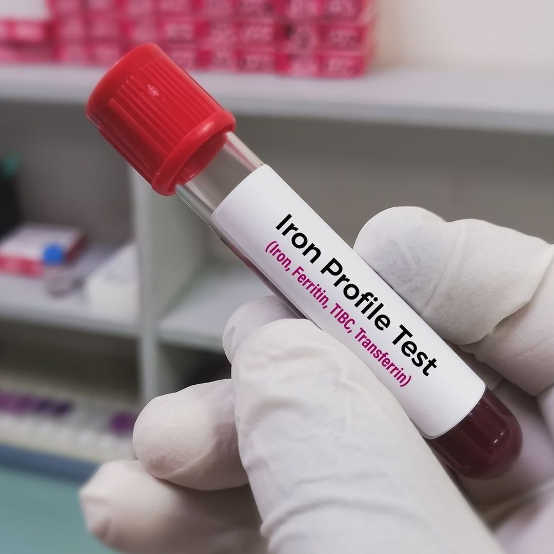 IRON STUDIES MONITORING PANEL - Arogga Online Lab