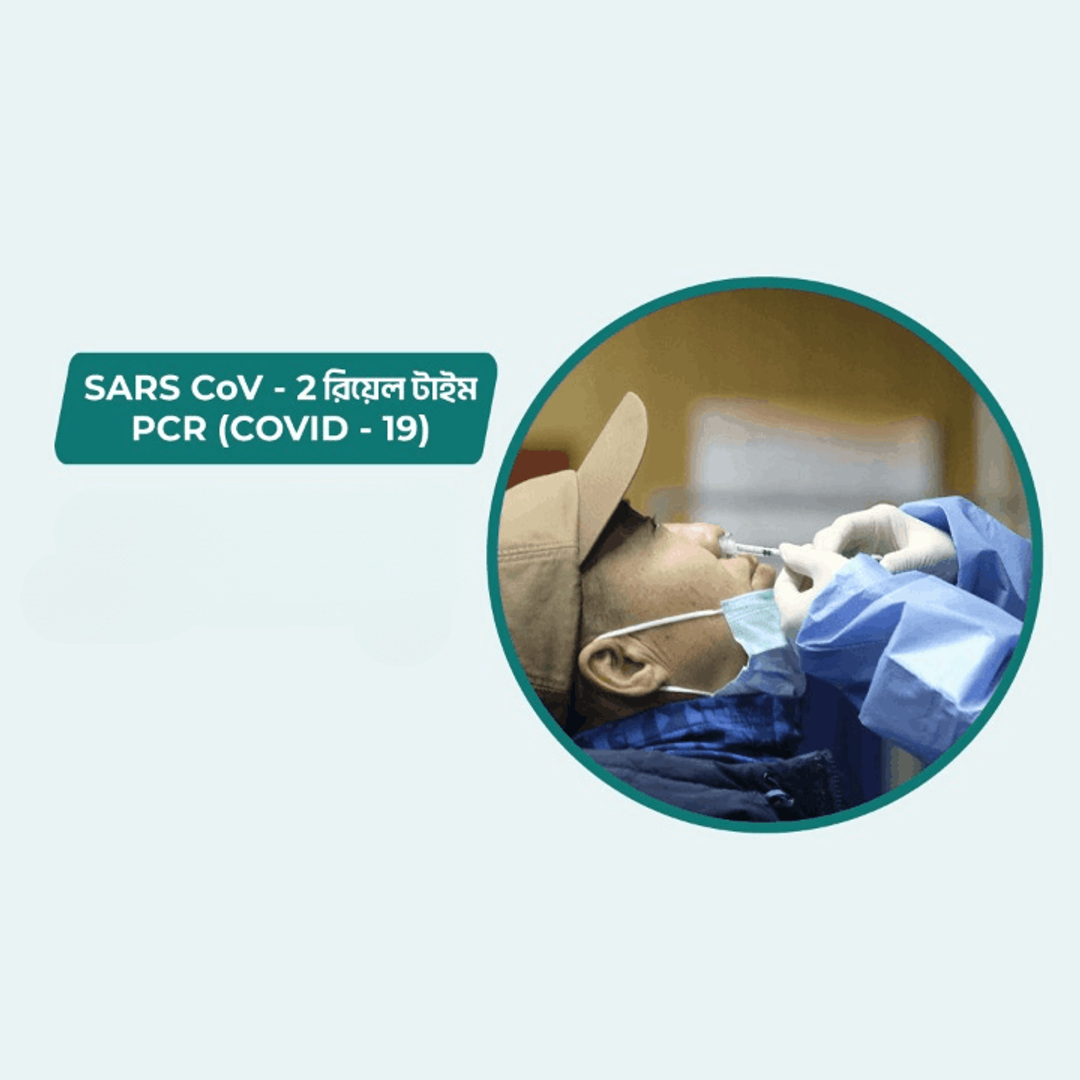 SARS CoV -2 REAL TIME PCR (COVID-19) - Arogga Online Lab