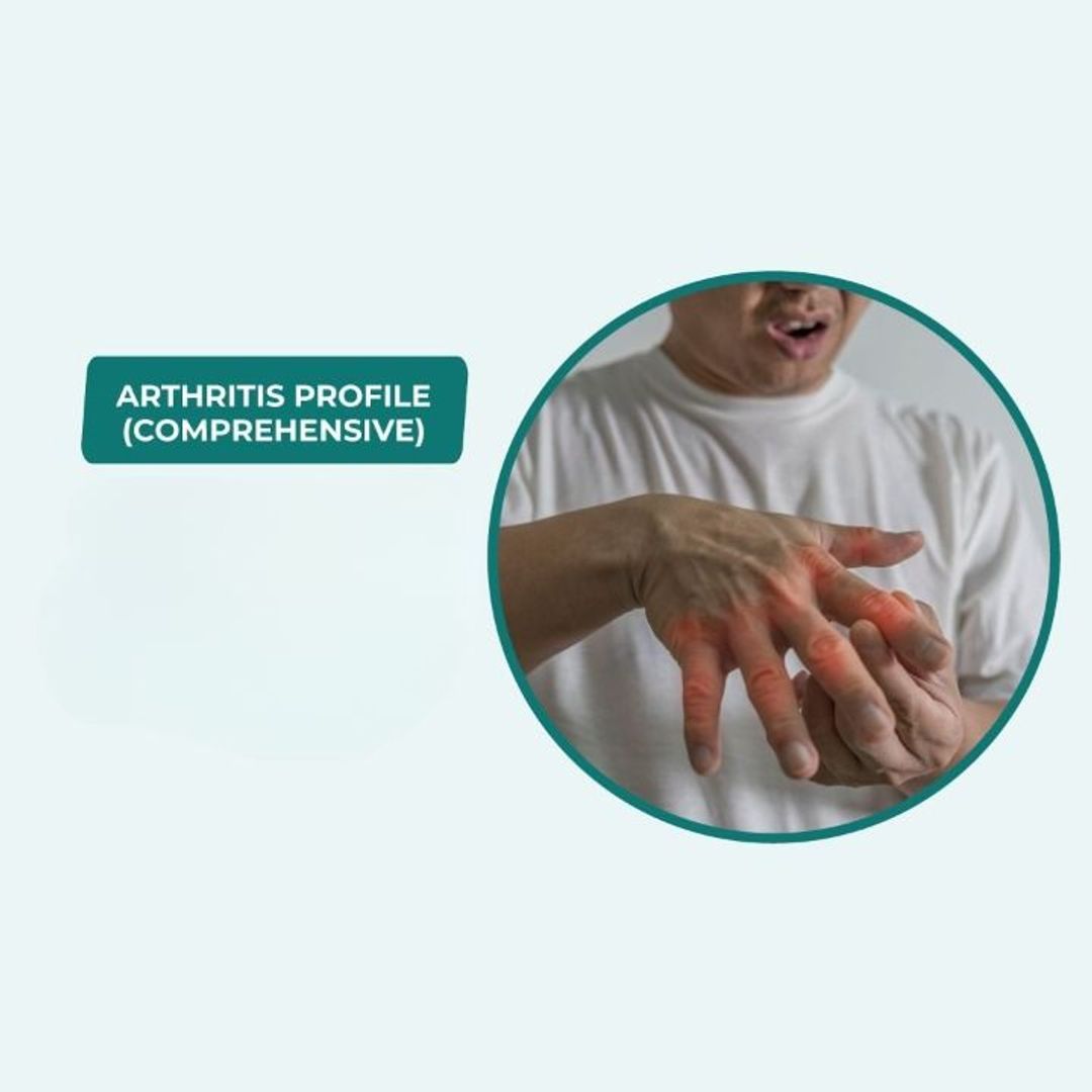 Arthritis Profile (COMPREHENSIVE) test Online in Dhaka | Arogga Online Lab