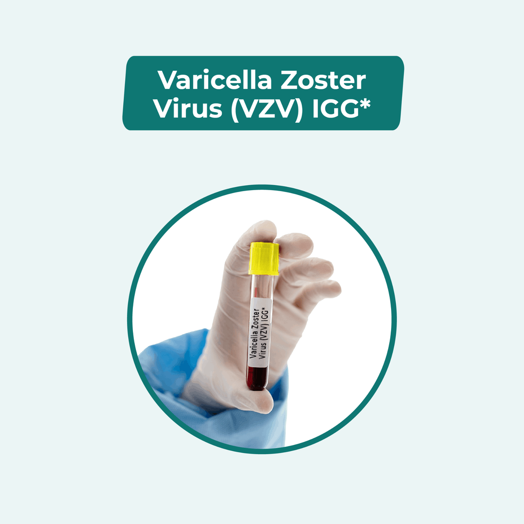 Varicella Zoster Virus (VZV) IgG - Arogga Online Lab