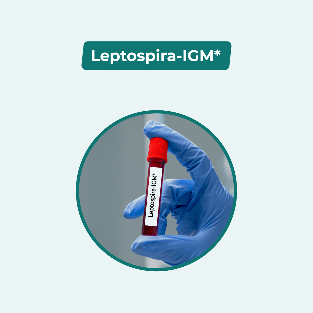 Leptospira-IGM - Arogga Online Lab