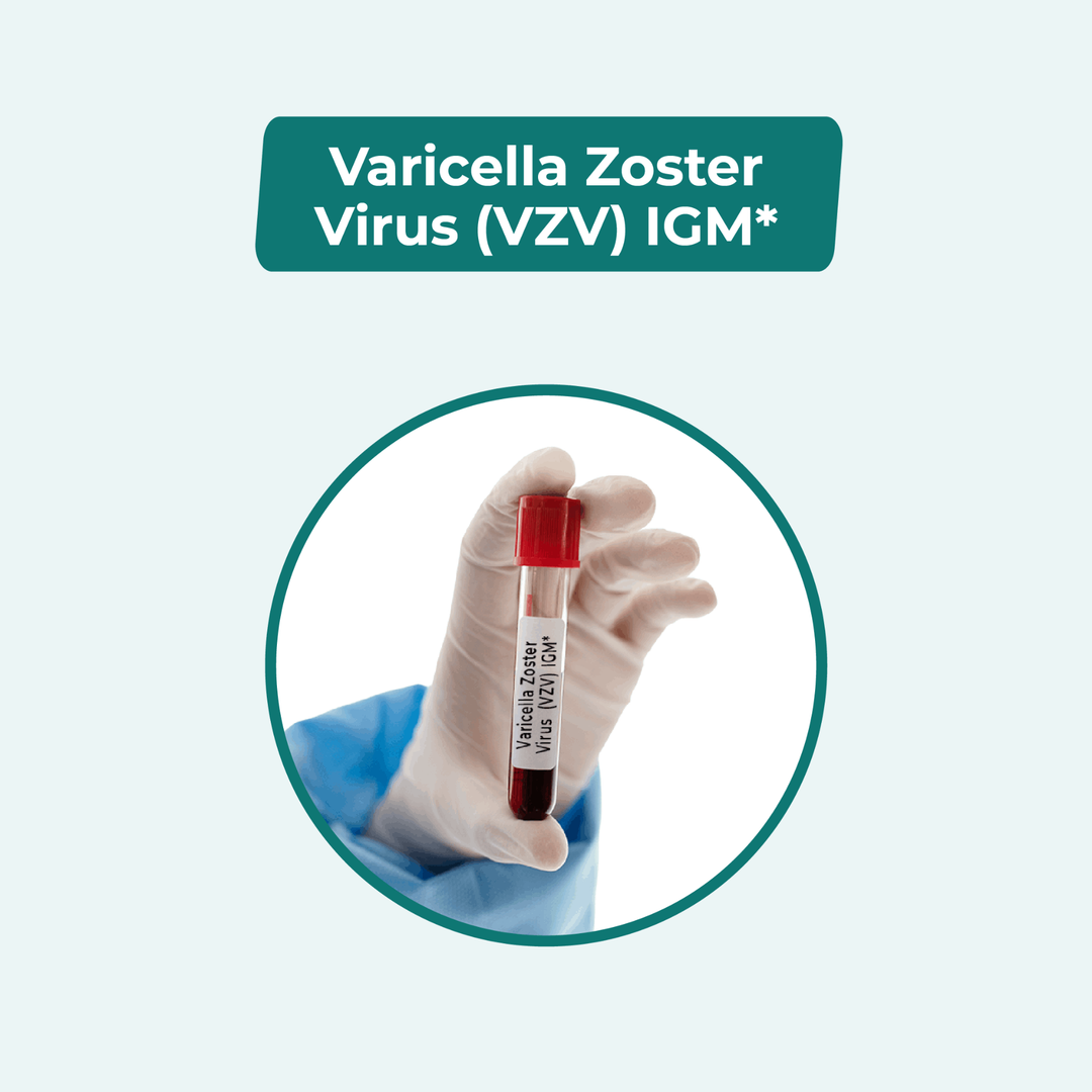 Varicella Zoster Virus (VZV) IgM test Online in Dhaka | Arogga Online Lab