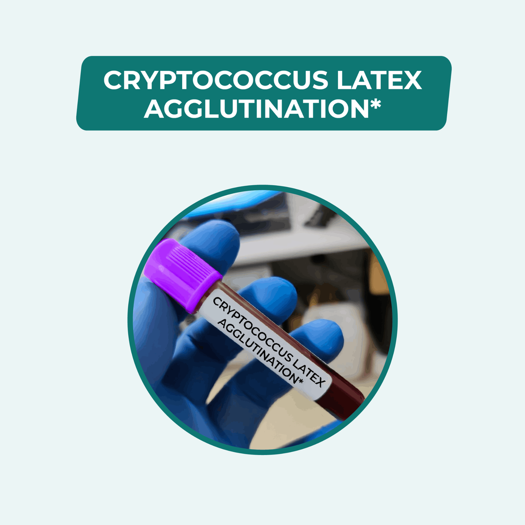 CRYPTOCOCCUS LATEX AGGLUTINATION - Arogga Online Lab