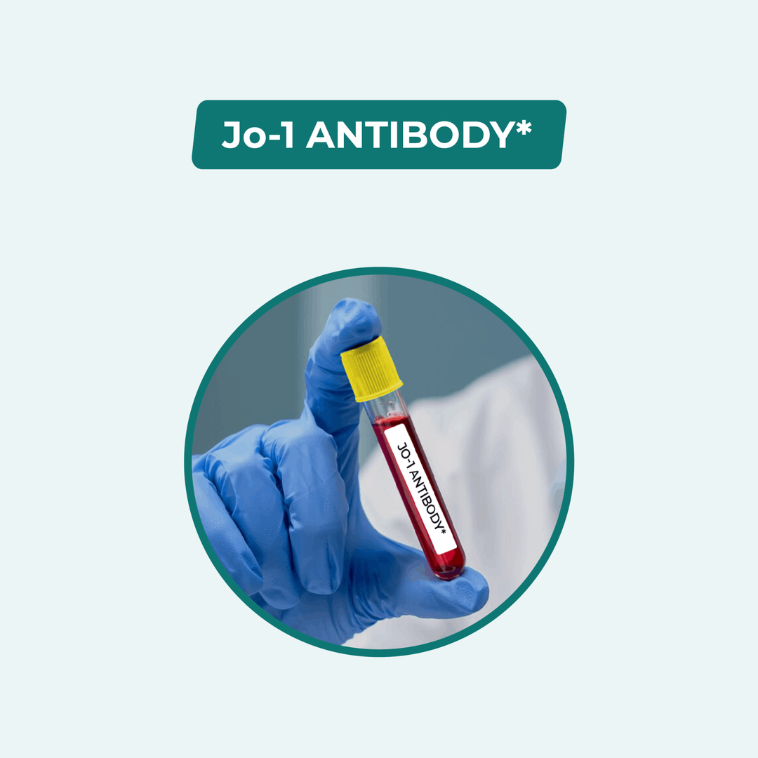 Jo-1 ANTIBODY - Arogga Online Lab