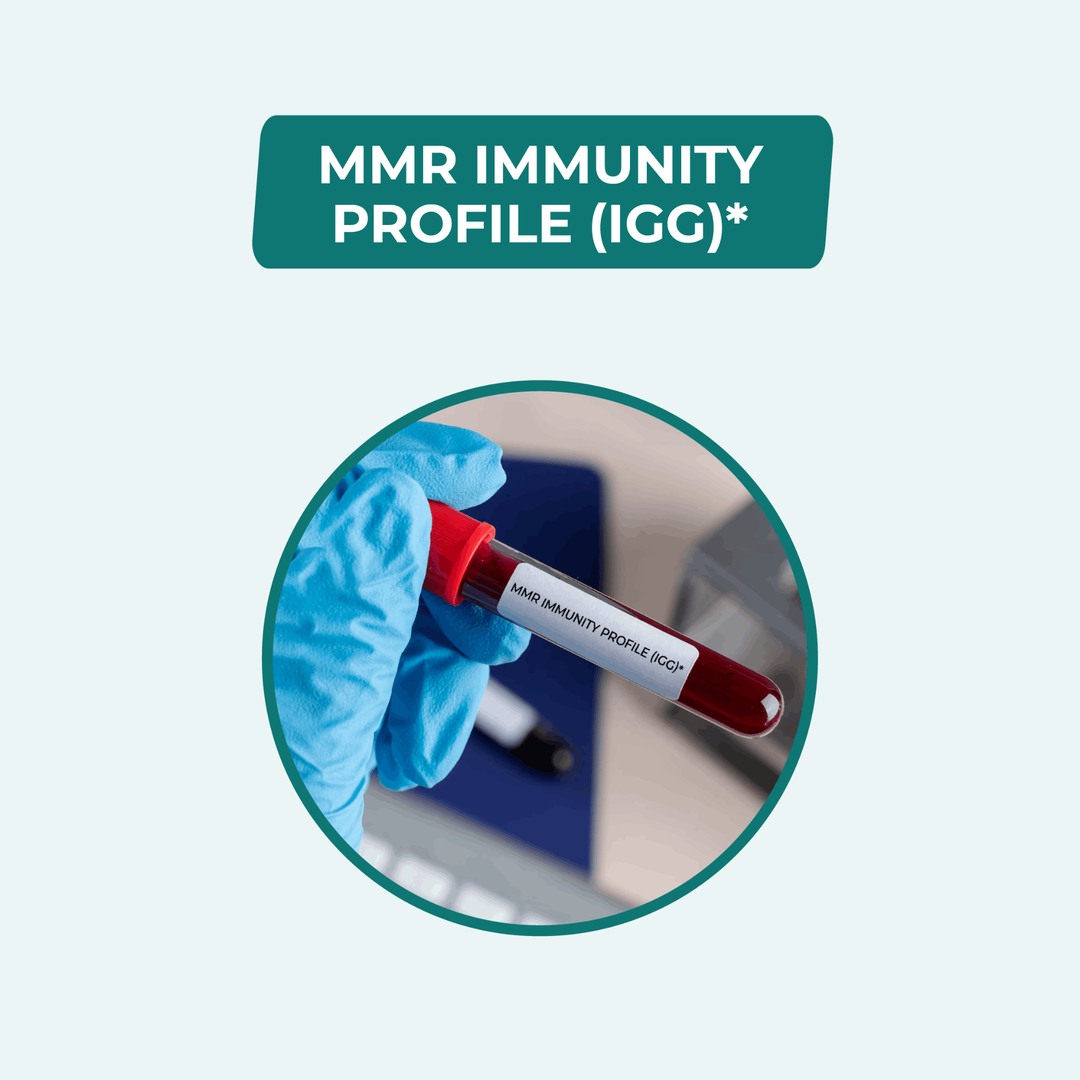 MMR IMMUNITY PROFILE (IGG) Test - Arogga Online Lab