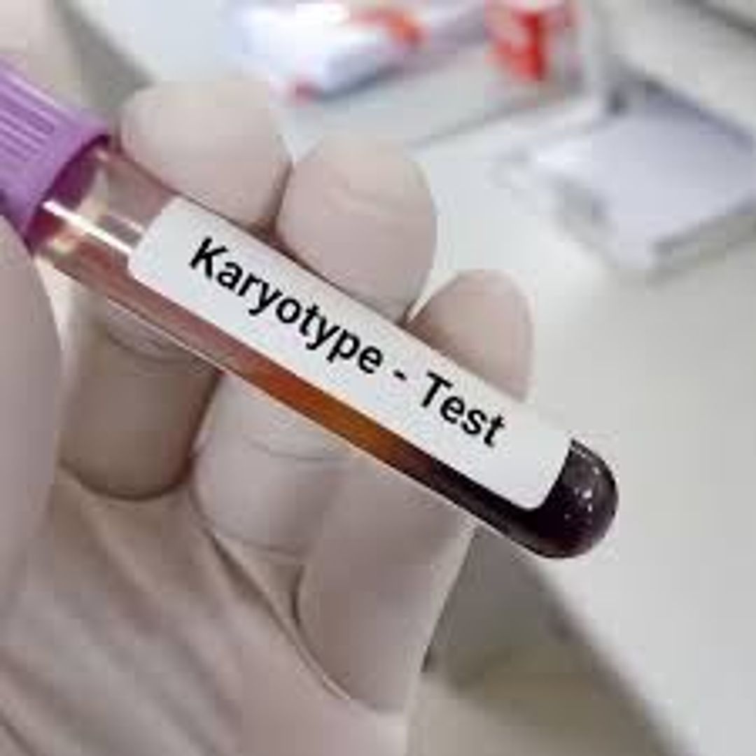Karyotyping test Online in Dhaka | Arogga Online Lab