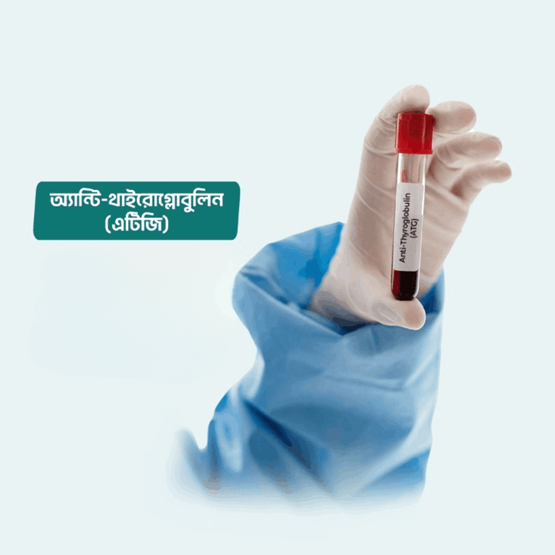 Anti Thyroglobulin (ATG) test Online in Dhaka | Arogga Online Lab