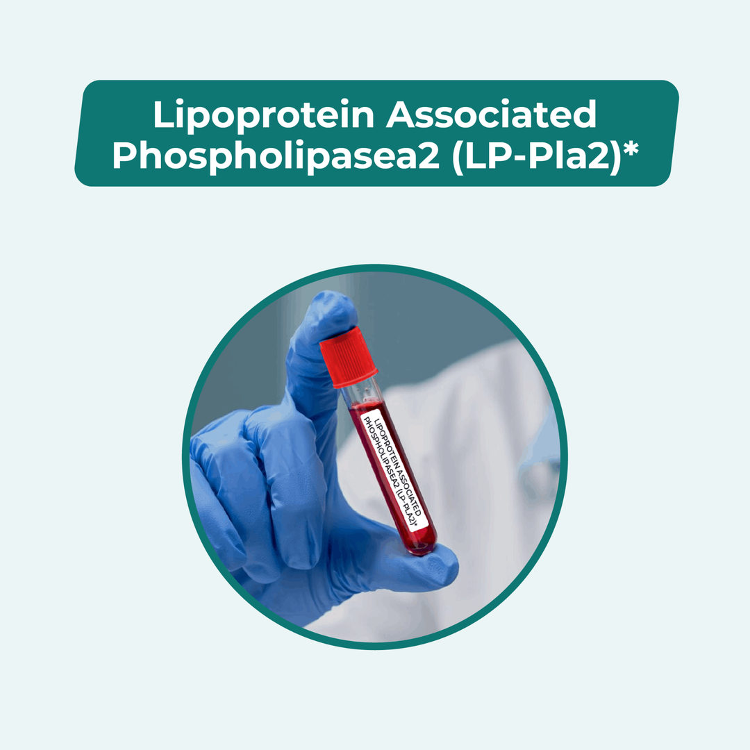 Lipoprotein Associated Phospholipasea2 (LP-Pla2) - Arogga Online Lab