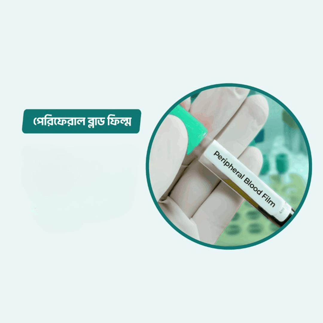 Peripheral Blood Film (PBF) test Online in Dhaka | Arogga Online Lab