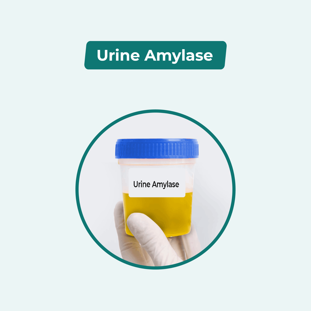 Urine Amylase - Arogga Online Lab