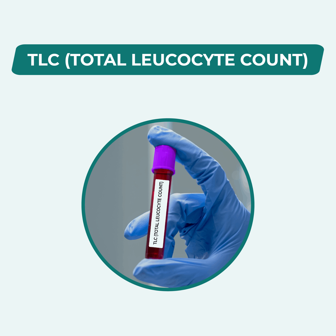 TLC (TOTAL LEUCOCYTE COUNT) - Arogga Online Lab