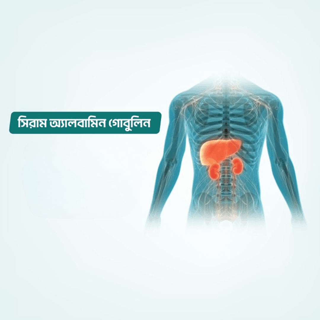 Urine for RBC (Morphology) - Arogga Online Lab