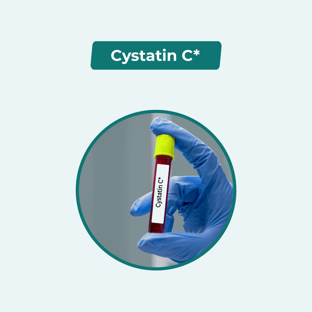 Cystatin C Serum - Arogga Online Lab